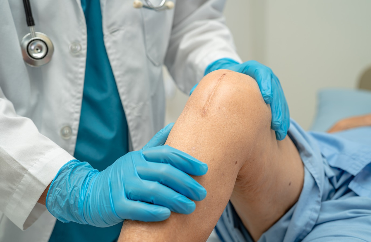 Understanding Joint Replacement Surgery: What to Expect and How to ...