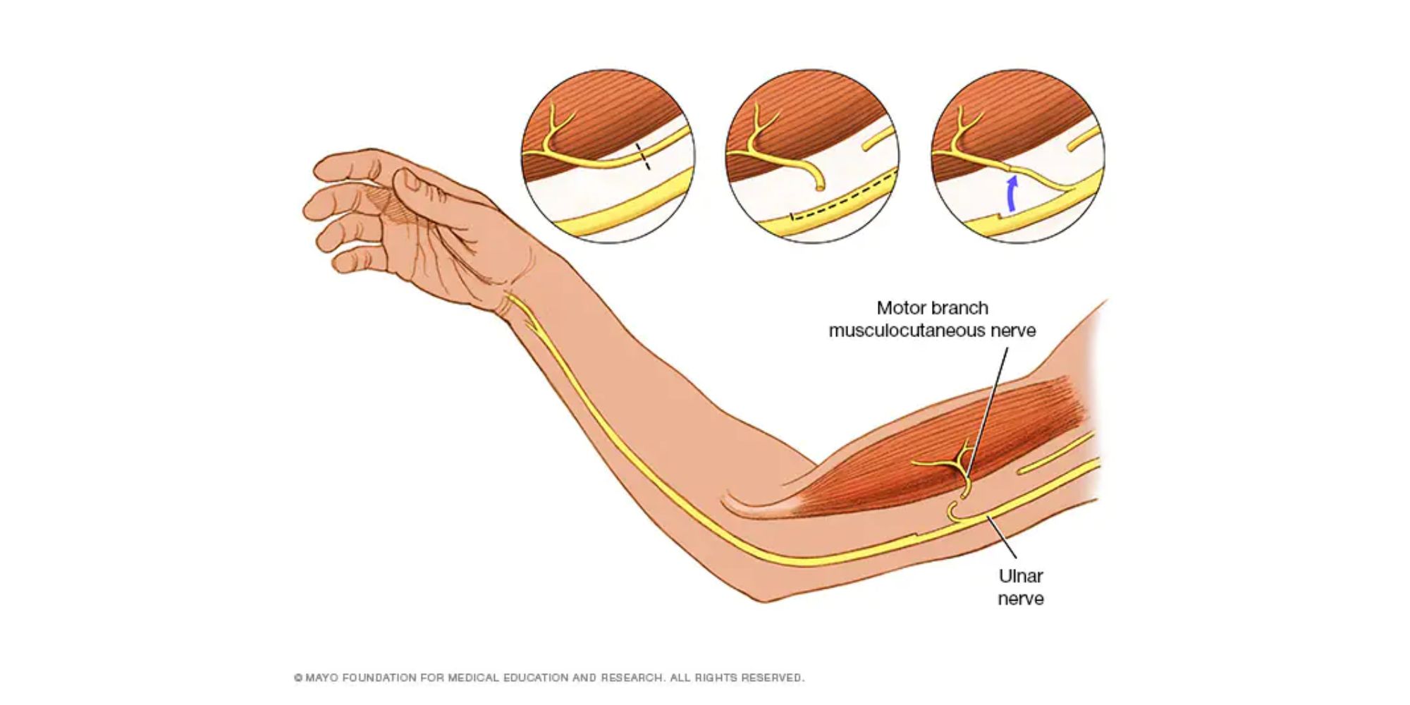 The Role of Microvascular Surgery in Modern Medicine